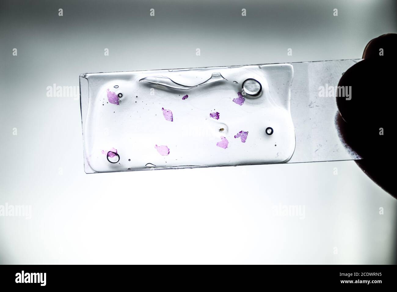 Skin cancer radiation hi-res stock photography and images - Alamy