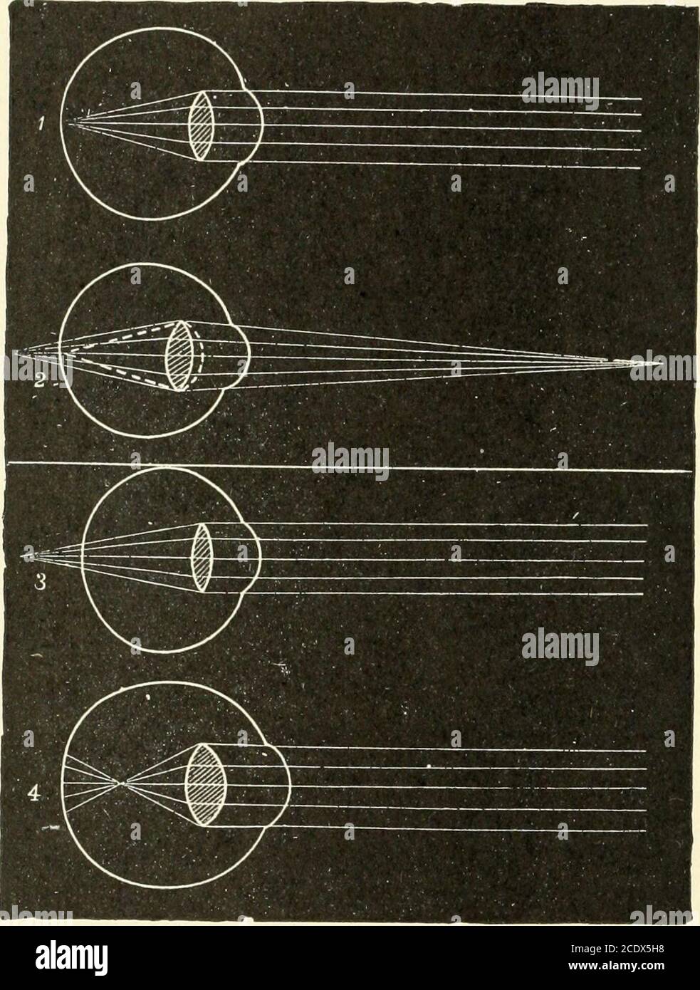 Diminished Range High Resolution Stock Photography and Images - Alamy