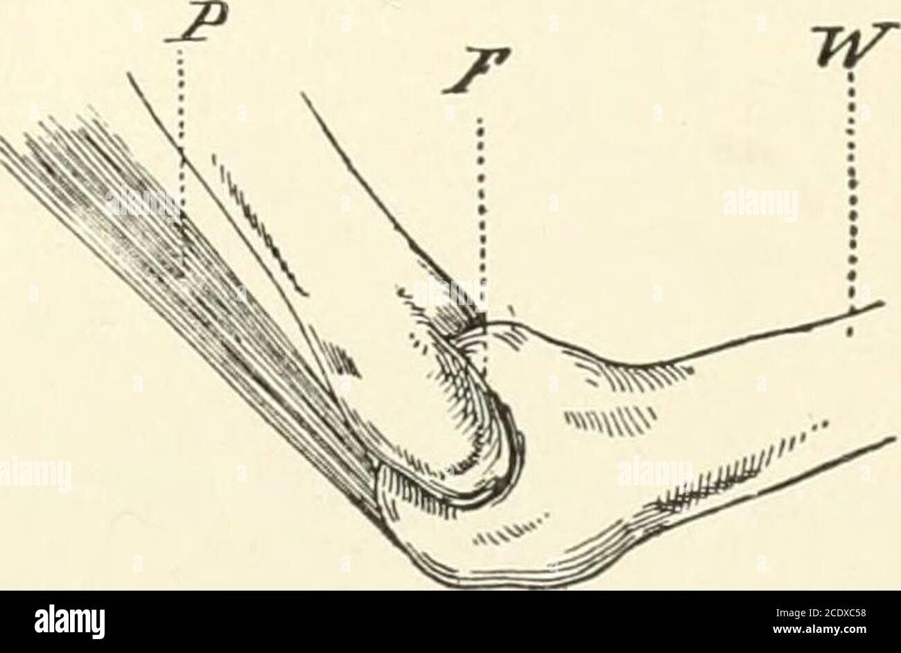 Stooping posture hi-res stock photography and images - Alamy