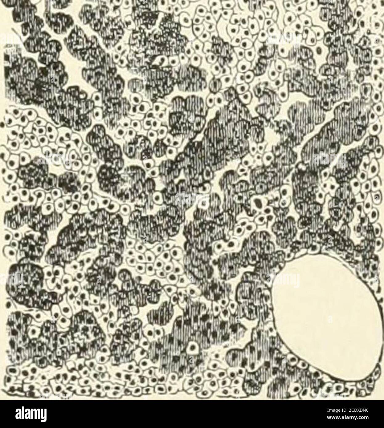 Adrenal capsule hi-res stock photography and images - Alamy
