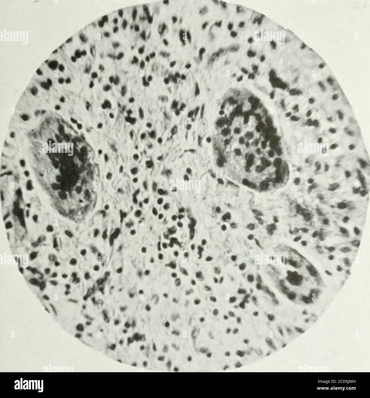 . Annals of surgery . rotocol of autopsy findings. Section performed ...