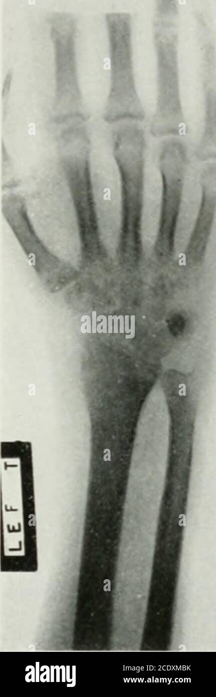 Dee flex hi-res stock photography and images - Alamy