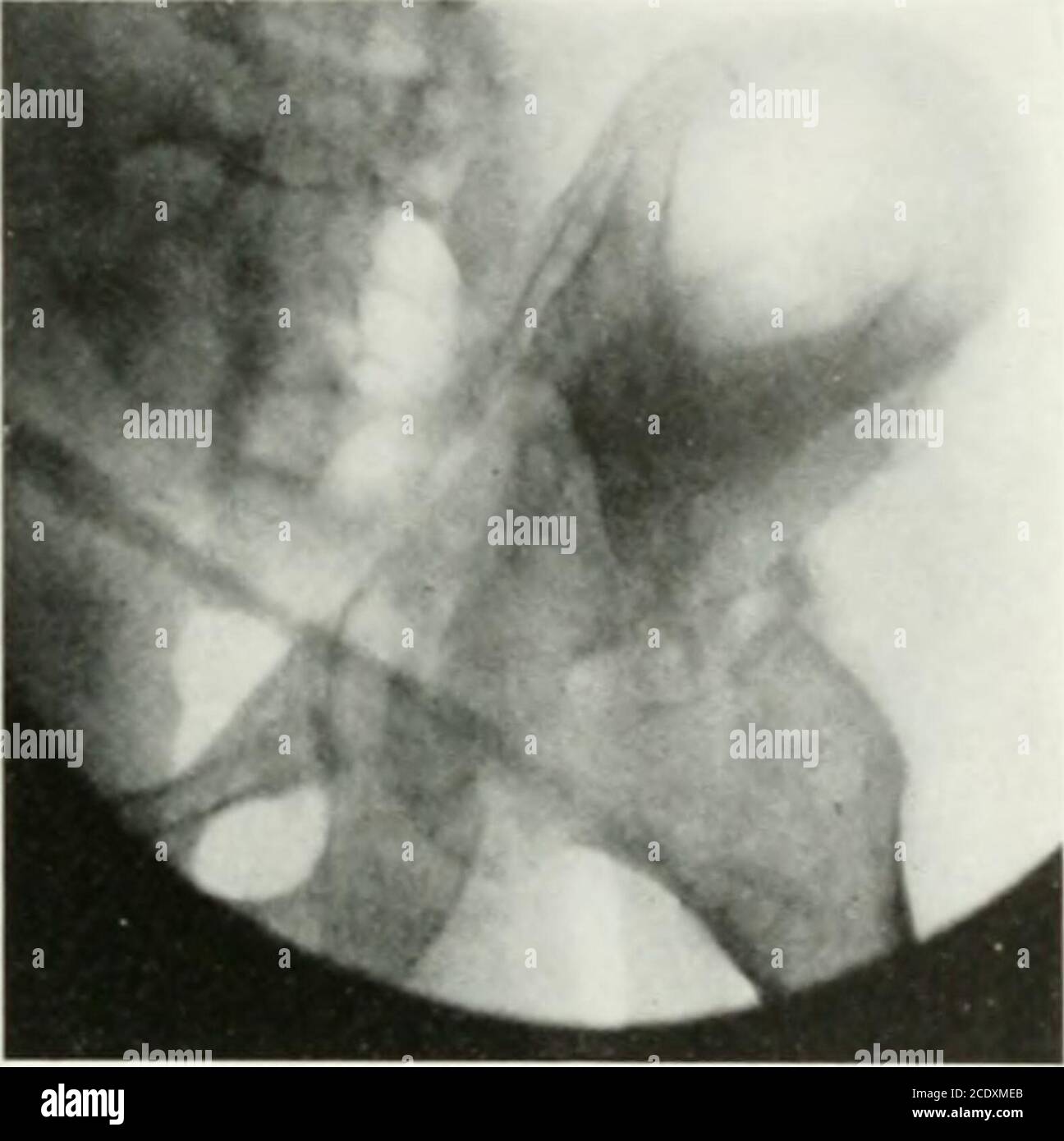 Limp posture hi-res stock photography and images - Alamy