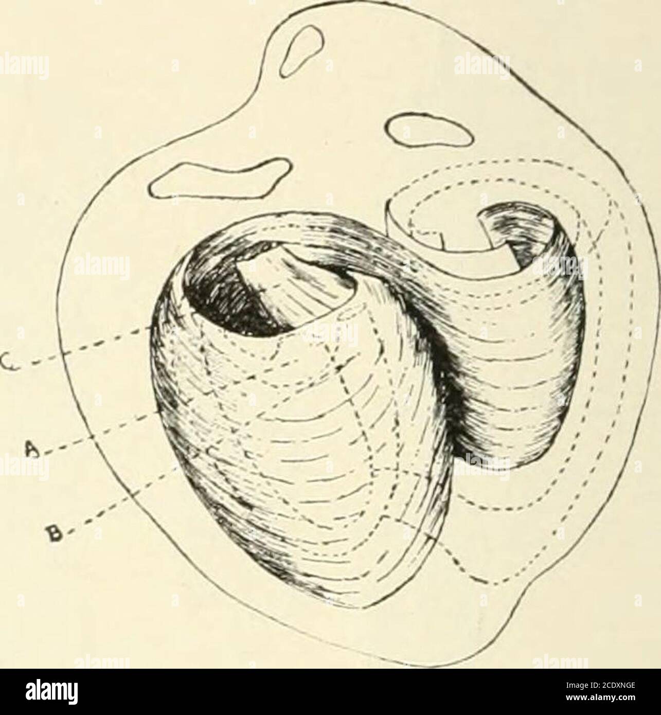 Posterior papillary muscle hi-res stock photography and images - Alamy