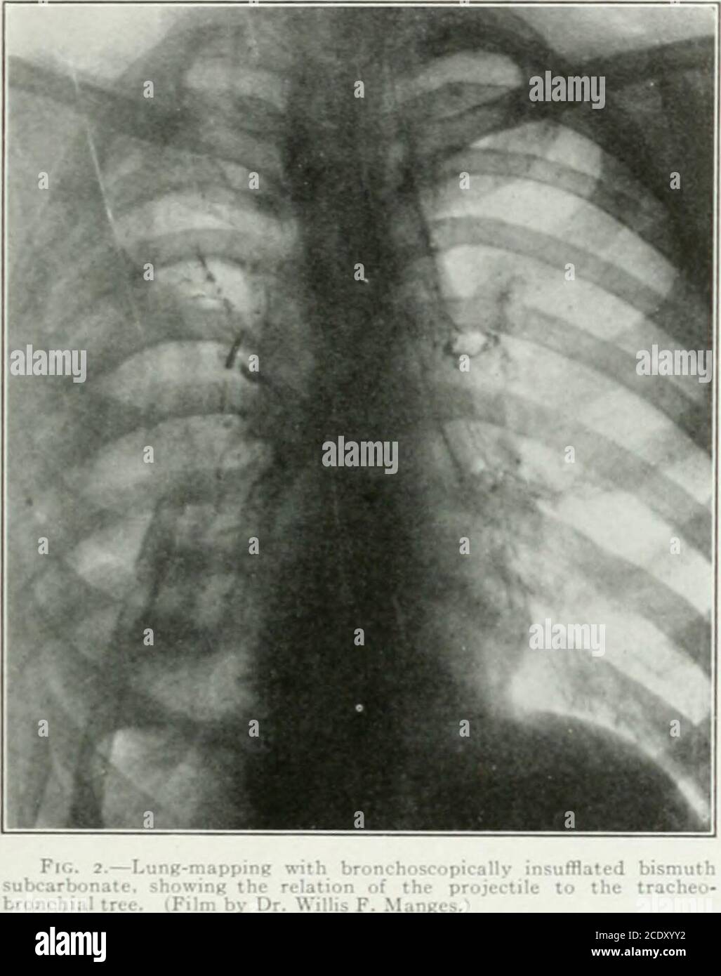 Conical wedge hi-res stock photography and images - Alamy