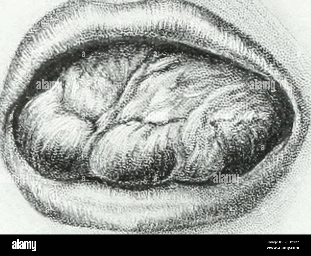 Left hypochondriac hi-res stock photography and images - Alamy