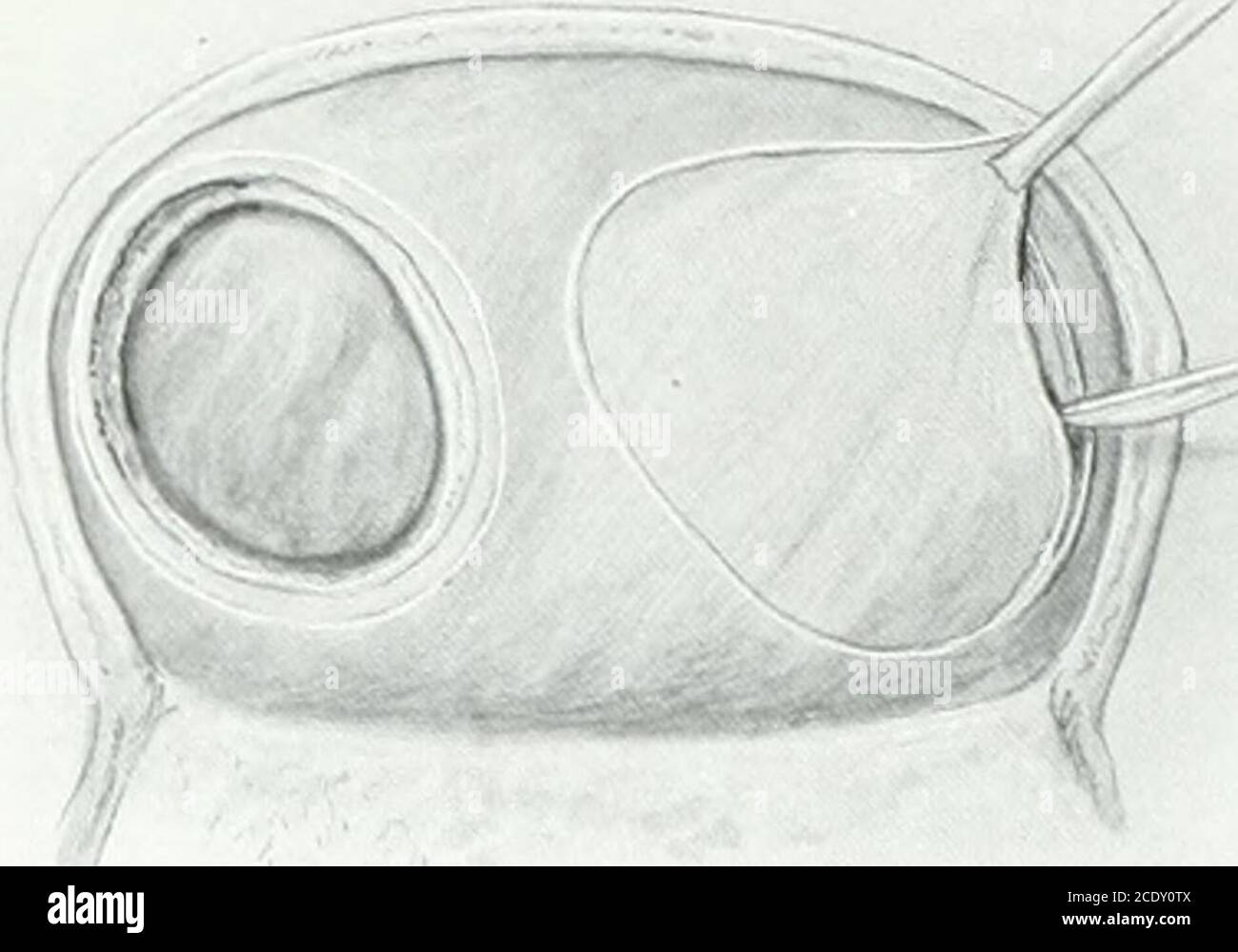 Extensor Surfaces High Resolution Stock Photography and Images - Alamy