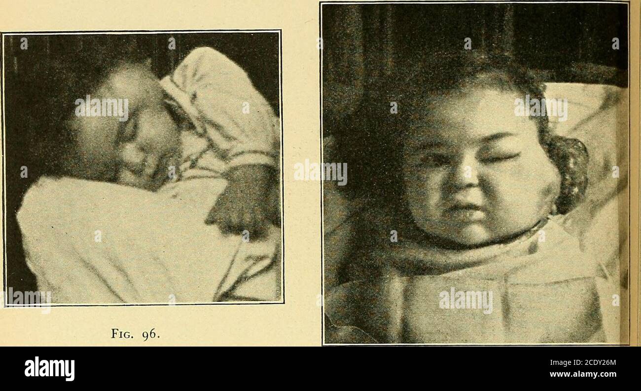 Large bone defect hi-res stock photography and images - Alamy