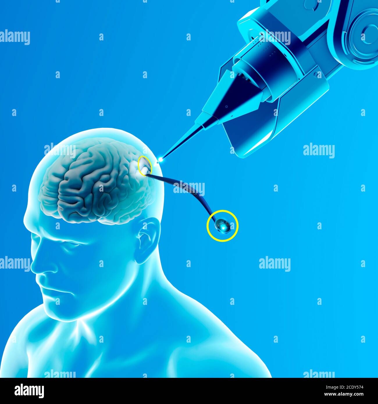 Link, neuralink, new artificial intelligence technology that allows you ...