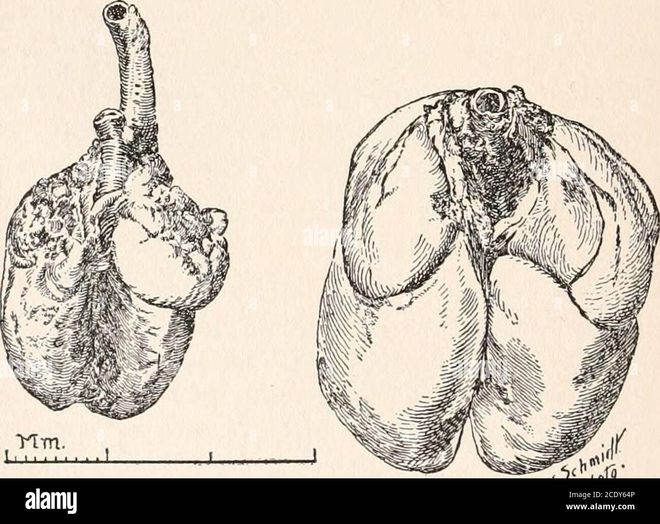 . The Popular science monthly . e thorax, the lungs do not collapse as ...