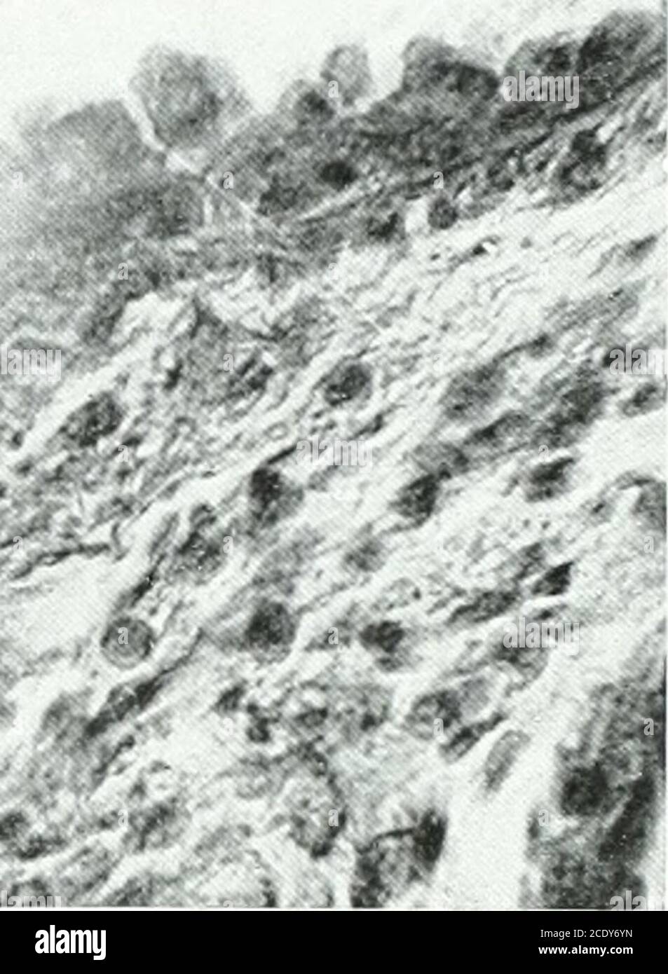 . Annals of surgery . or high colniunar epithelial cells. In the tissue ...