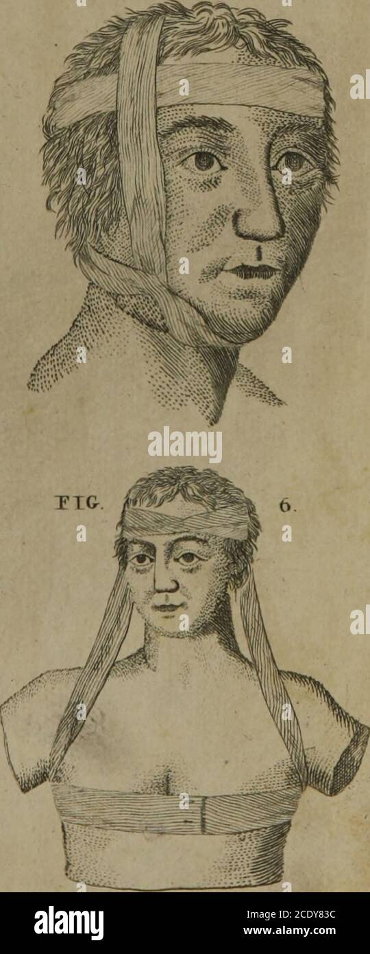 . A system of surgery (Volume 4) . PLATE C/HTIG 1. rtG Stock Photo - Alamy