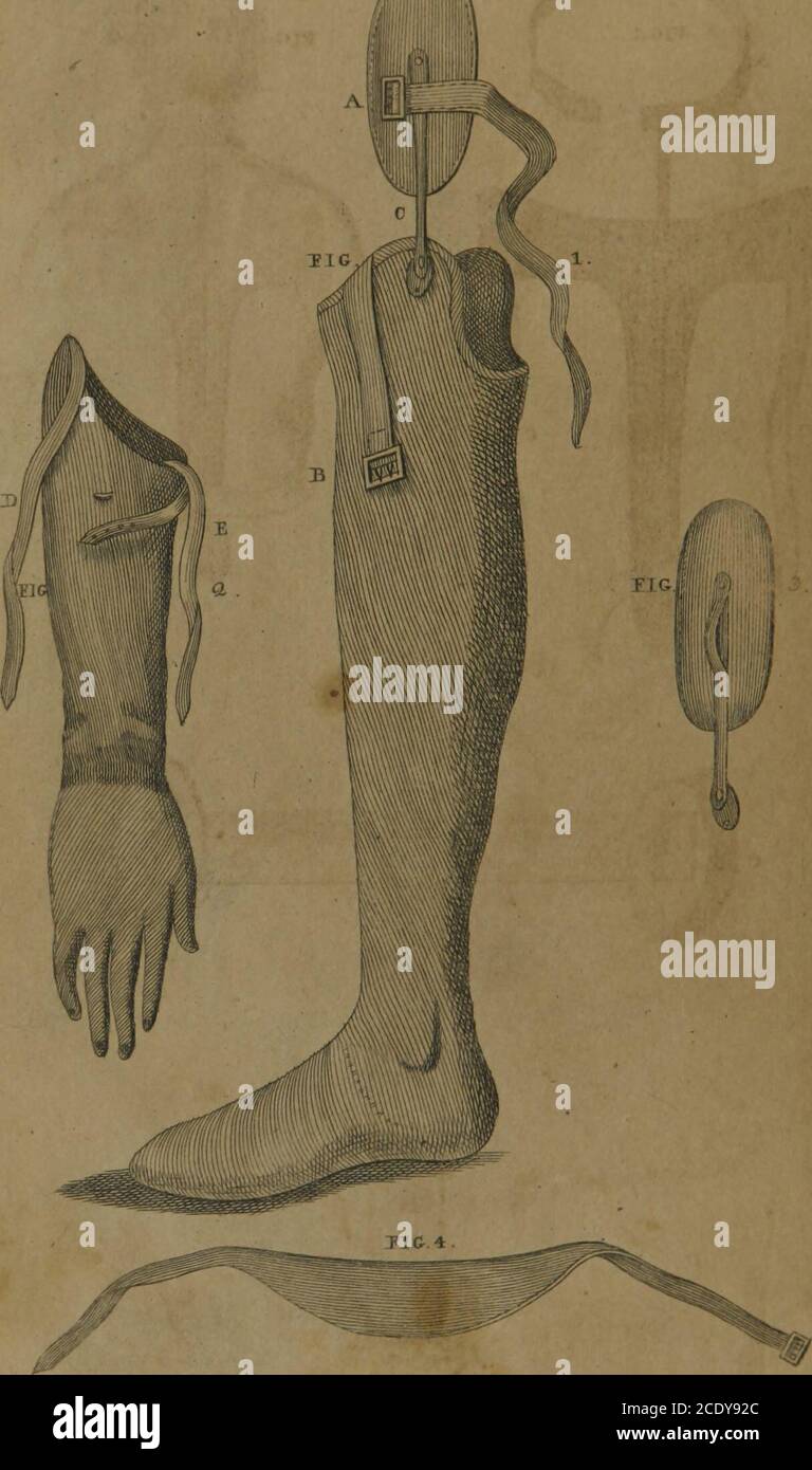 . A system of surgery (Volume 4) . PLATE CI Stock Photo - Alamy