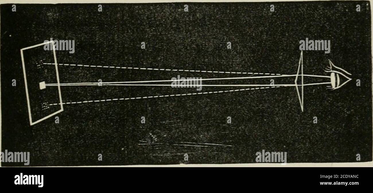 . The clinical use of prisms; and the decentering of lenses . efes near ...