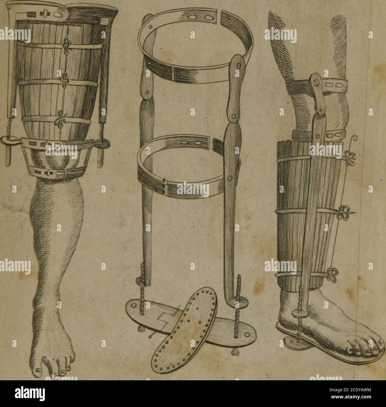 . A system of surgery (Volume 4) . TIG-. 4. FIG-. 1. FIG. 2.. JFIG.5 ...