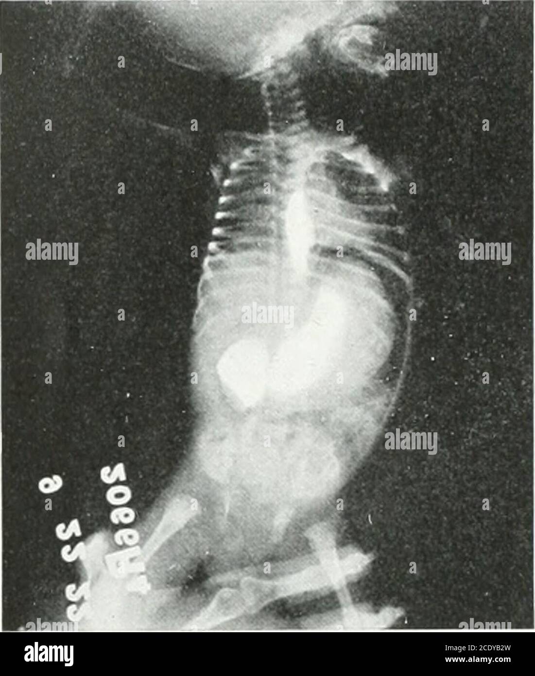 Gall bladder surface hi-res stock photography and images - Alamy