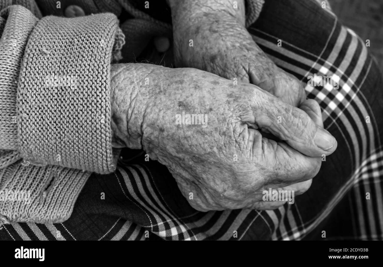 Senile spots hi-res stock photography and images - Alamy