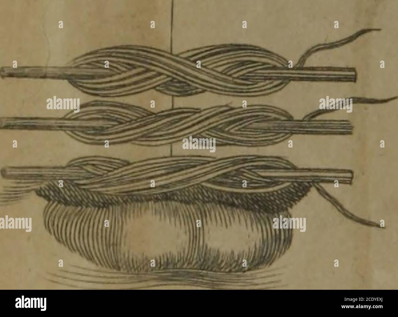. A system of surgery (Volume 4) . ?% FfG 3. JIG 4 Stock Photo - Alamy