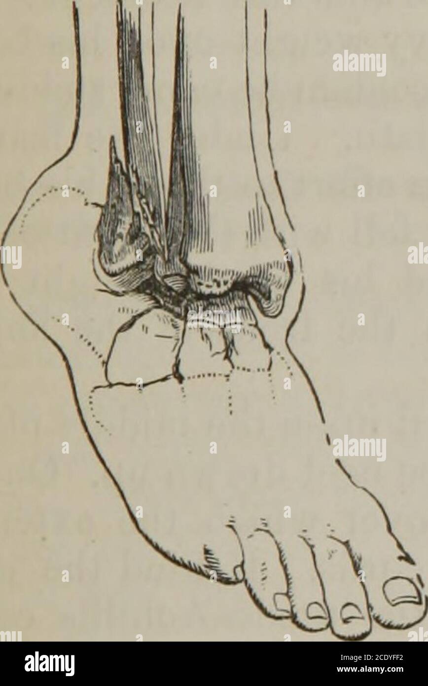 Bottom of foot anatomy hi-res stock photography and images - Alamy