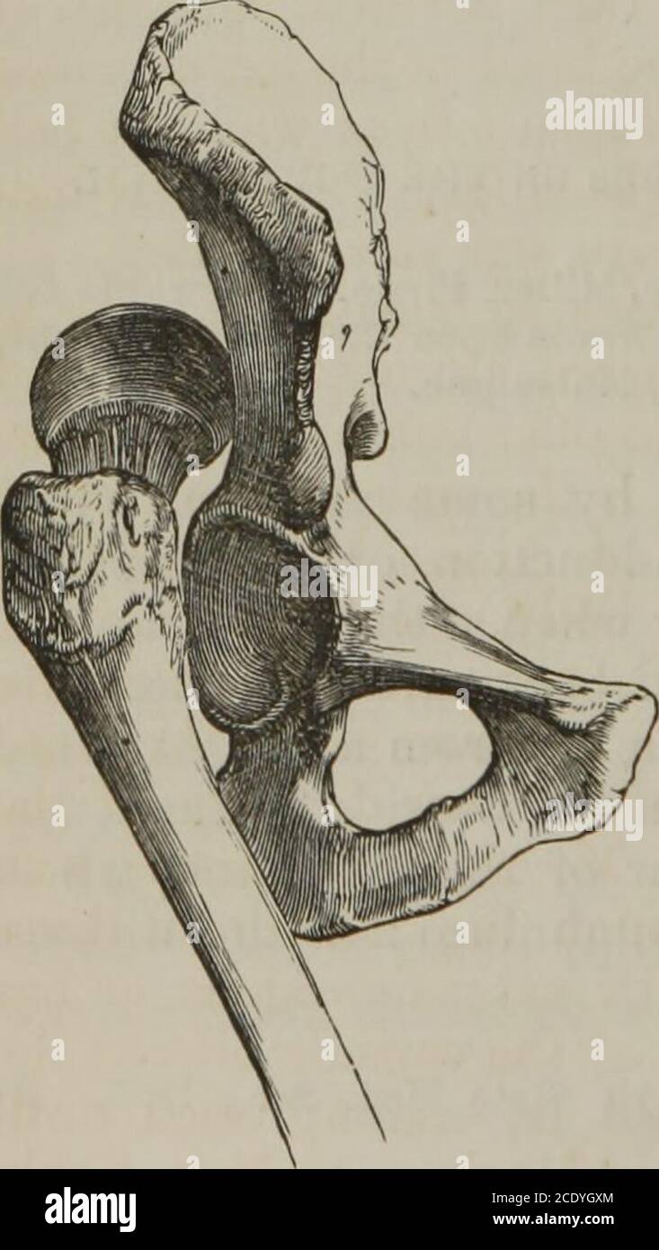 Round ligament of the femur hi-res stock photography and images - Alamy