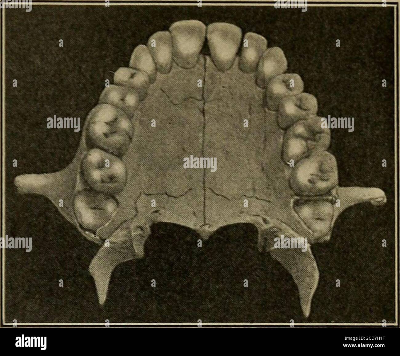 Milk teeth skull hi-res stock photography and images - Alamy