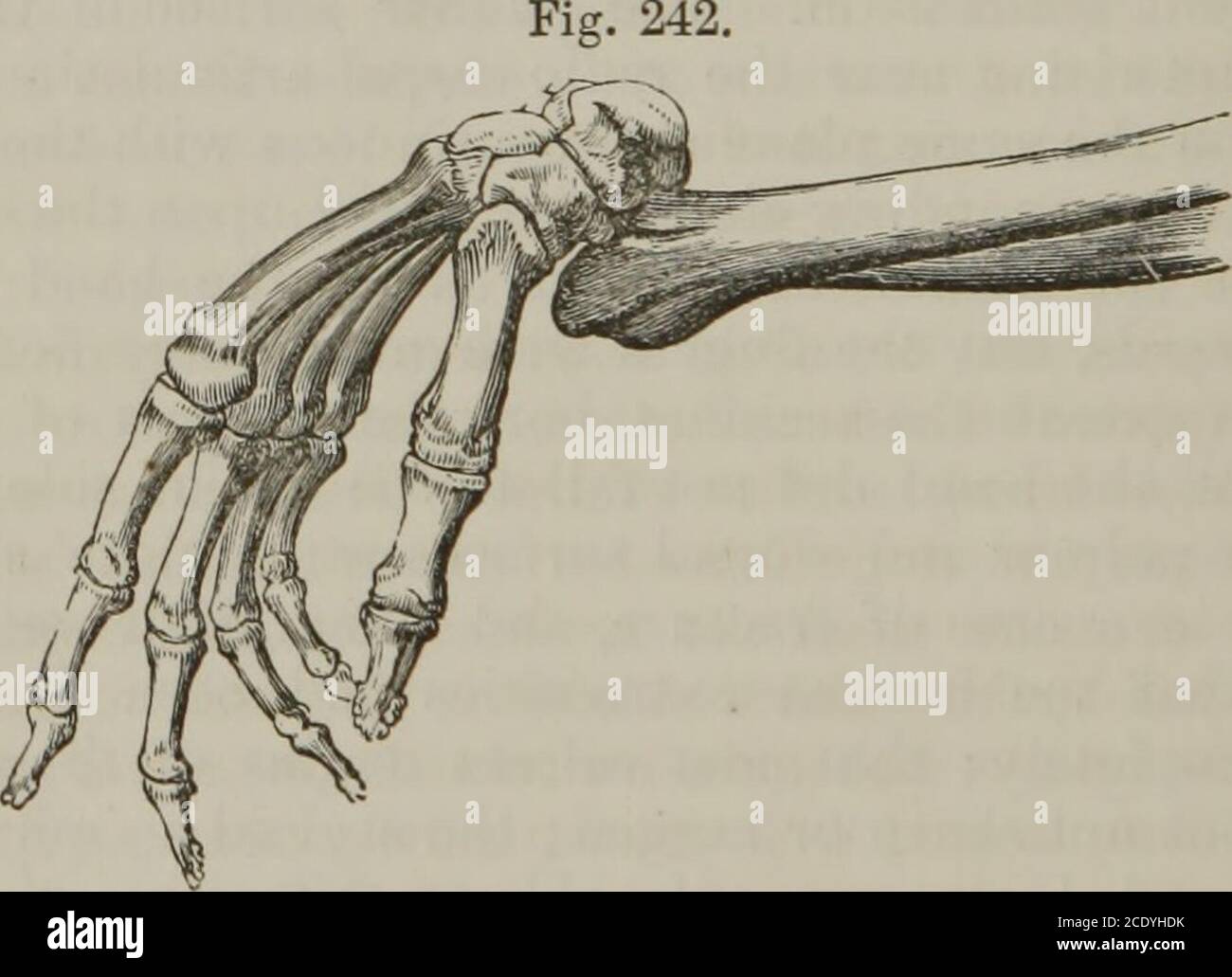 Muscles of anterior forearm hi-res stock photography and images - Alamy