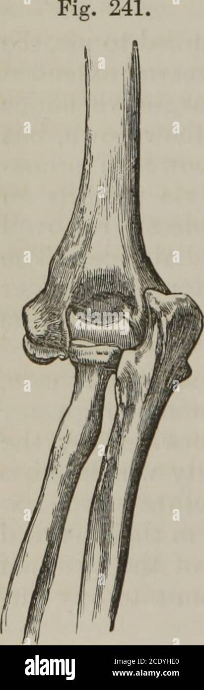 Ulnar nerve injury hi-res stock photography and images - Alamy