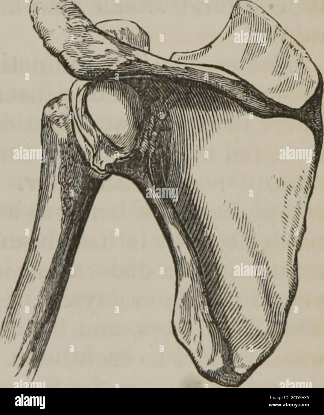 . A practical treatise on fractures and dislocations . e hasbeen ...