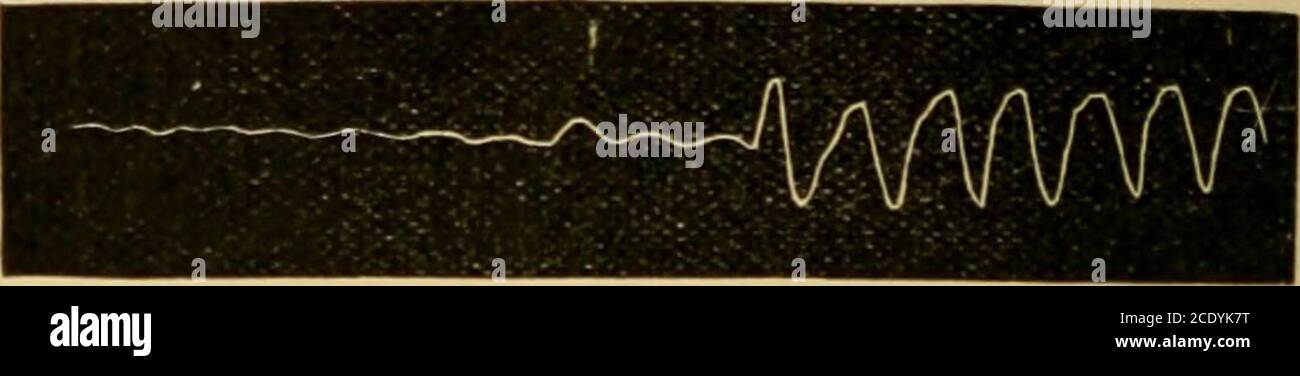 Pneumograph High Resolution Stock Photography and Images - Alamy