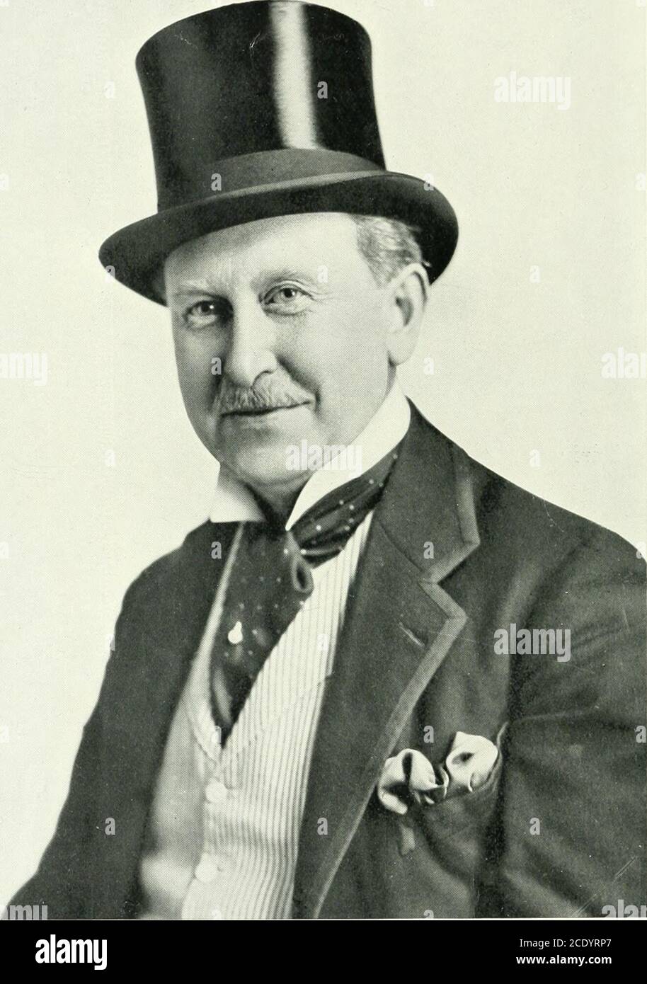 . The British journal of dermatology . sed typical neurodermatitis of a ...