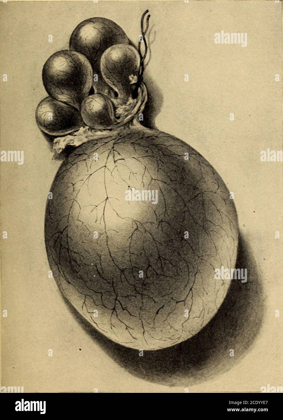 Ransohoff hi-res stock photography and images - Alamy