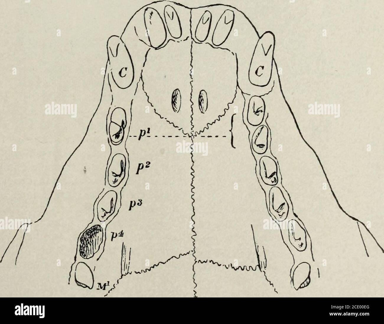 Supernumerary teeth hi-res stock photography and images - Alamy