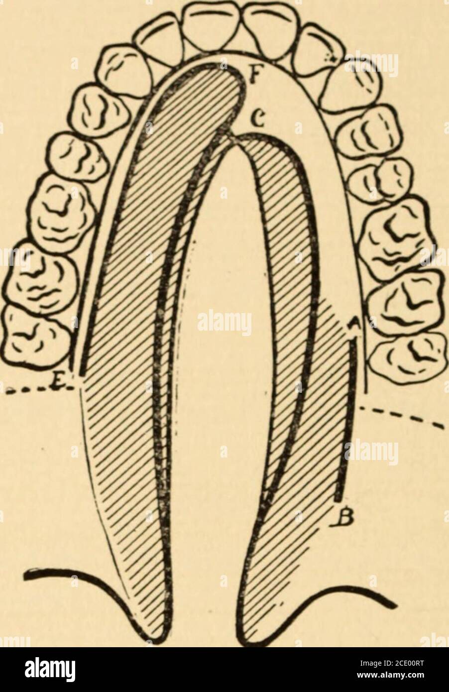 Intermaxillary bone hi-res stock photography and images - Alamy