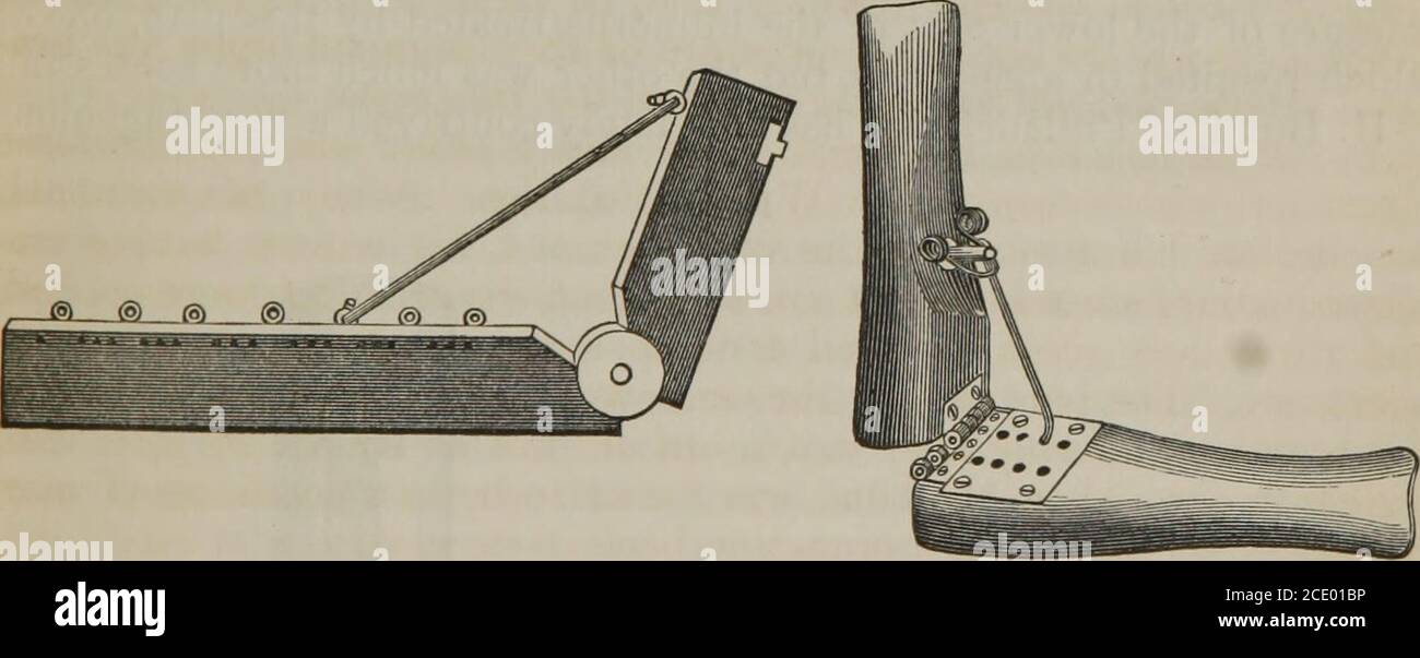 The thomas splint hi-res stock photography and images - Alamy
