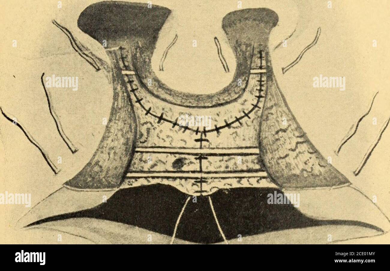 Chin cord hi-res stock photography and images - Alamy