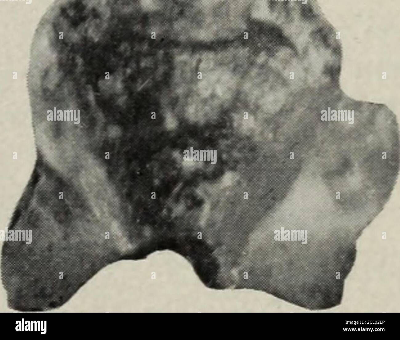 . The Dental cosmos . esthesia a surgeon removed the externalalveolar ...