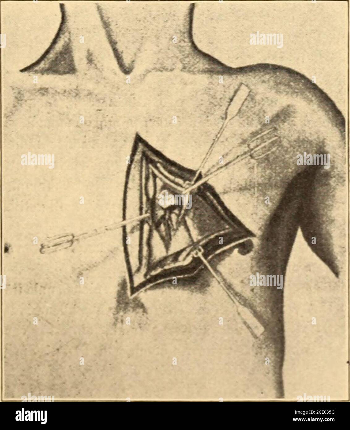 . Transactions of the Southern Surgical and Gynecological Association ...