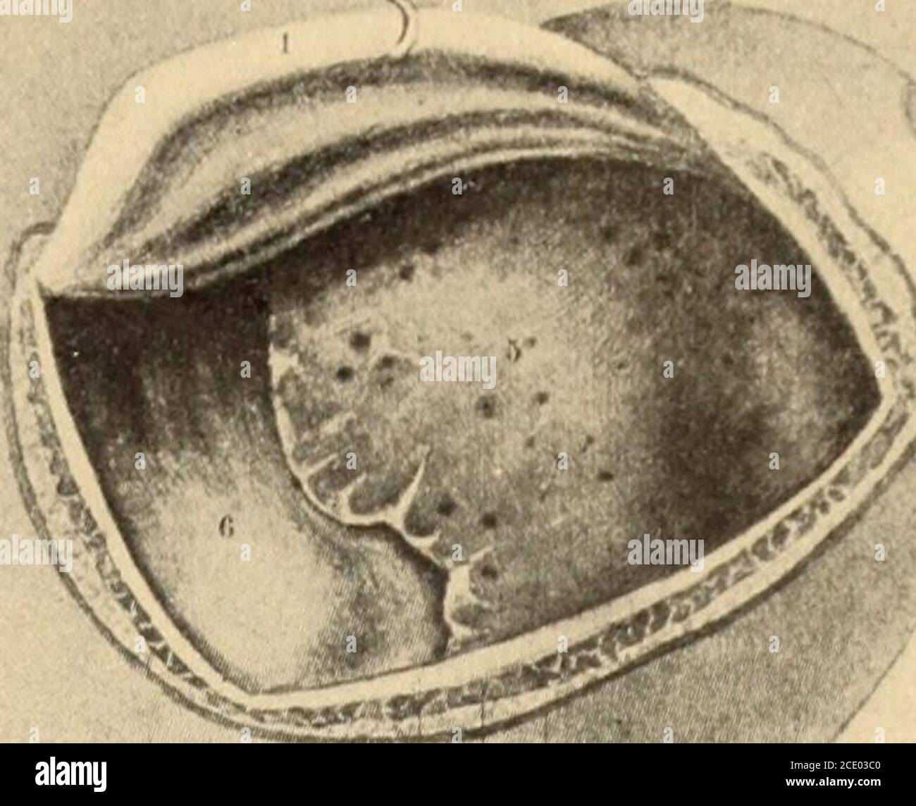 Thoracotomy hi-res stock photography and images - Alamy