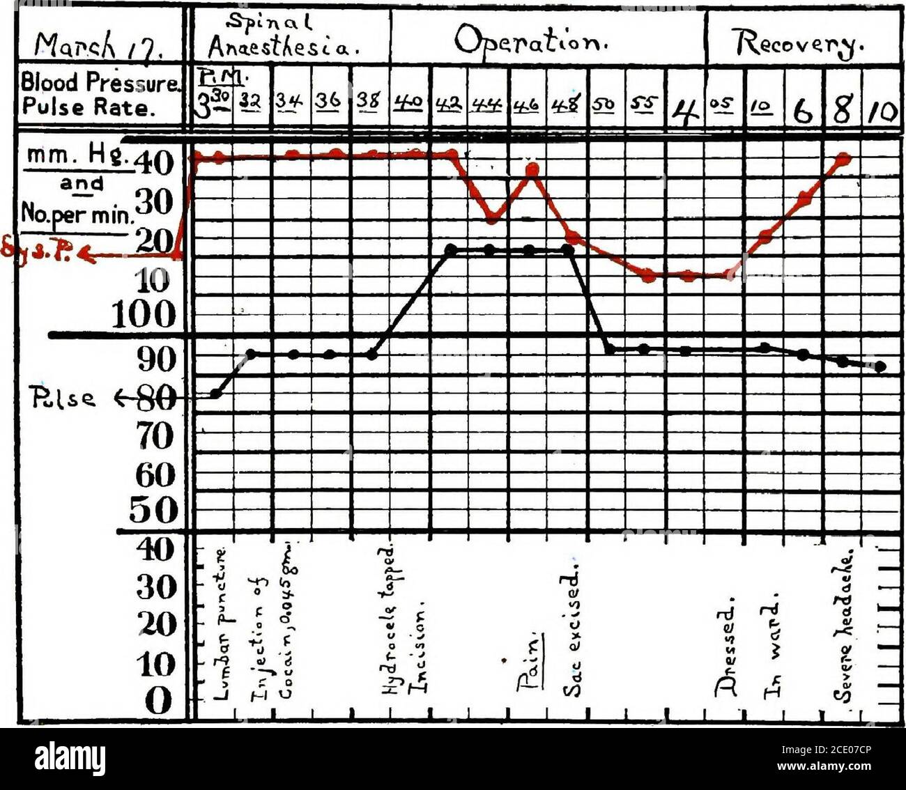 Blood Pressure Pulse Readings