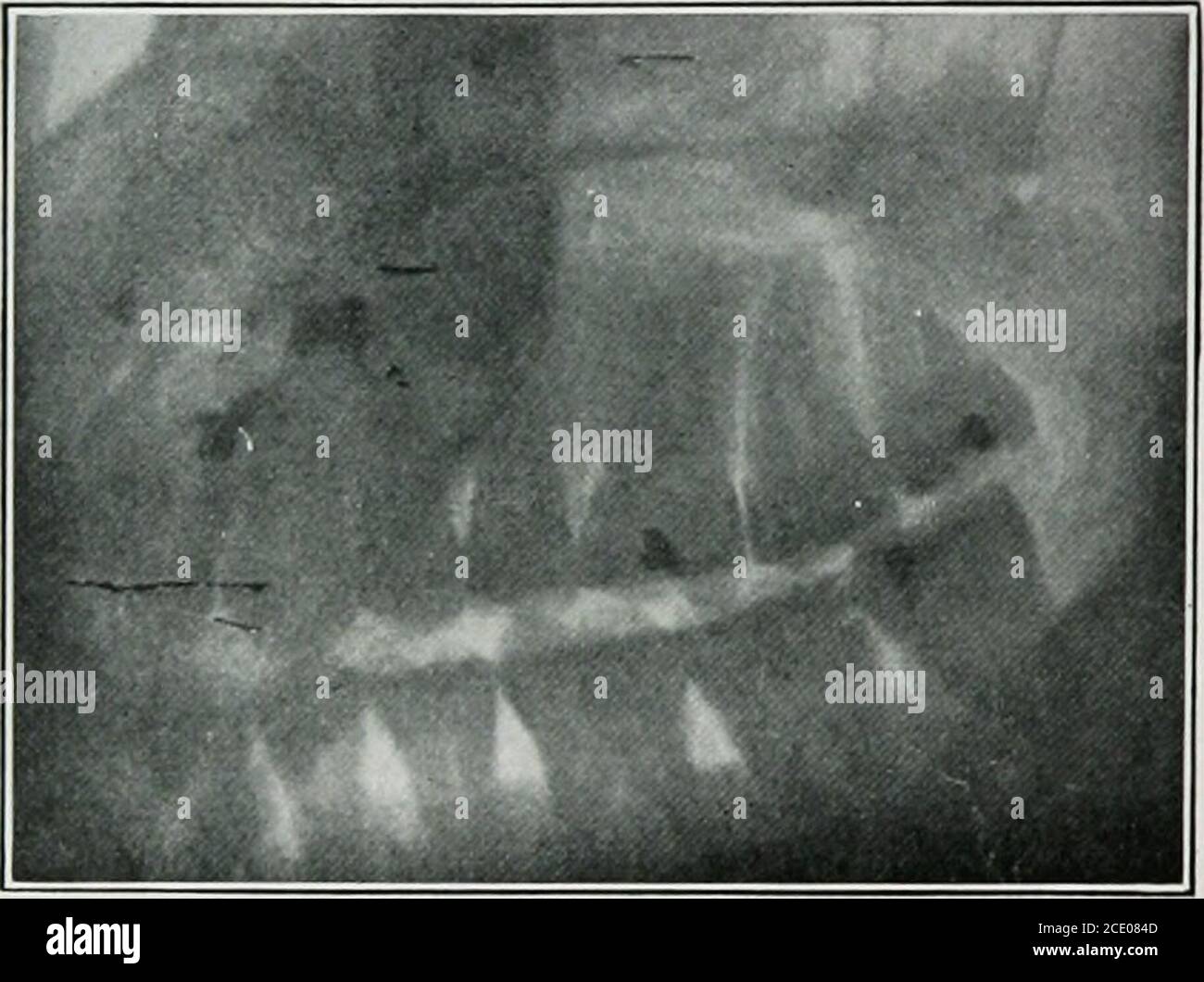 . Periodontal disease and its treatment by ionic medication . ival ...