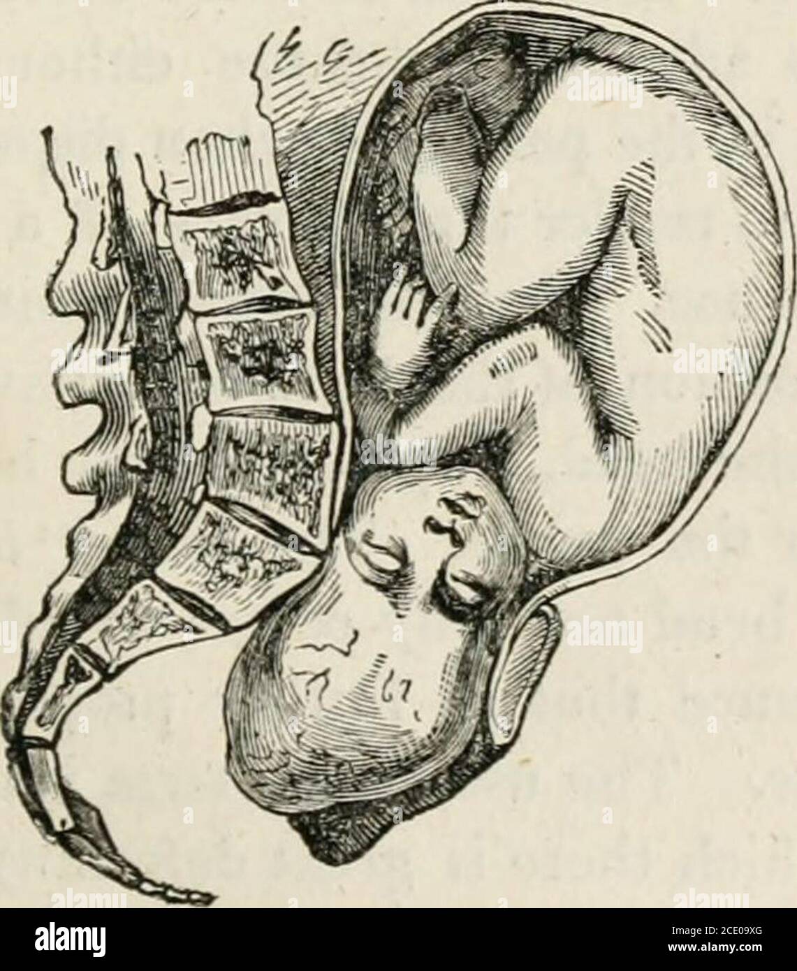 Rickets Head High Resolution Stock Photography and Images - Alamy