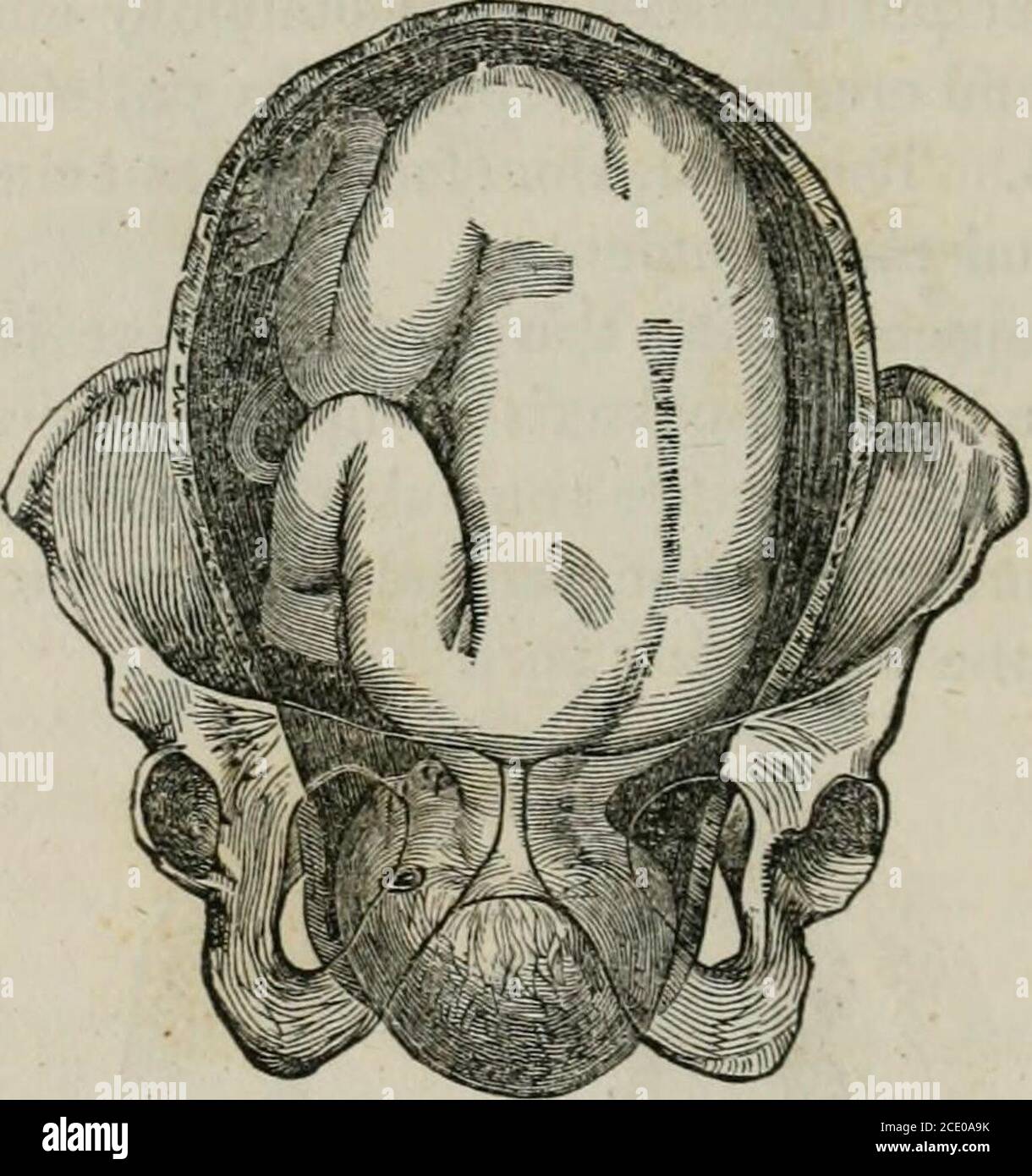 . Lectures on natural and difficult parturition . The head within the ...