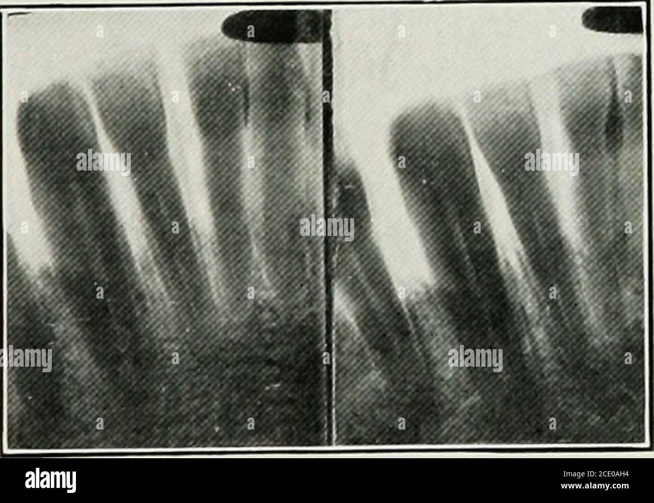 Linea dura hi-res stock photography and images - Alamy