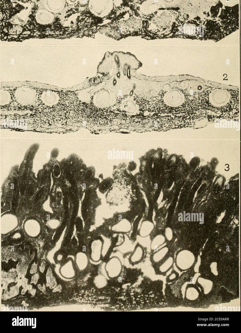 . Endothia parasitica and related species . Ms Ai*. ENDOTHIA PARASITICA ...