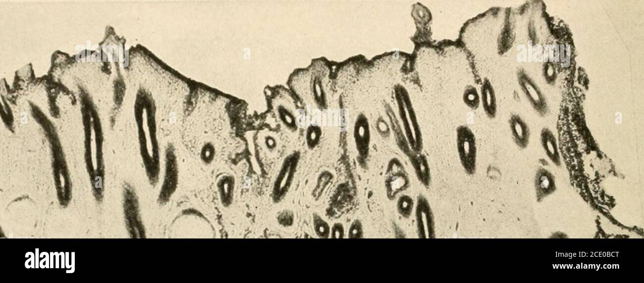 . Endothia parasitica and related species . Endothia sinqularis. Ve ...