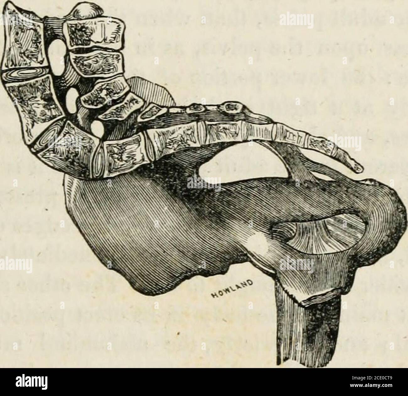 . Lectures on natural and difficult parturition . Ovate Pelvis with ...