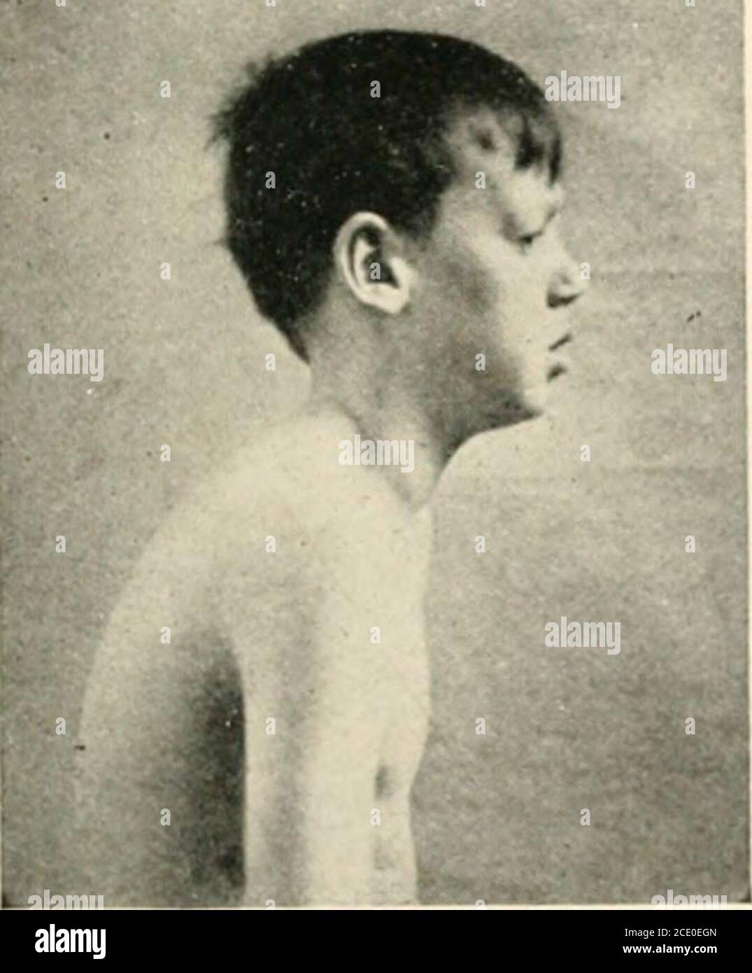 . The conservation of the child; a manual of clinical psychology ...