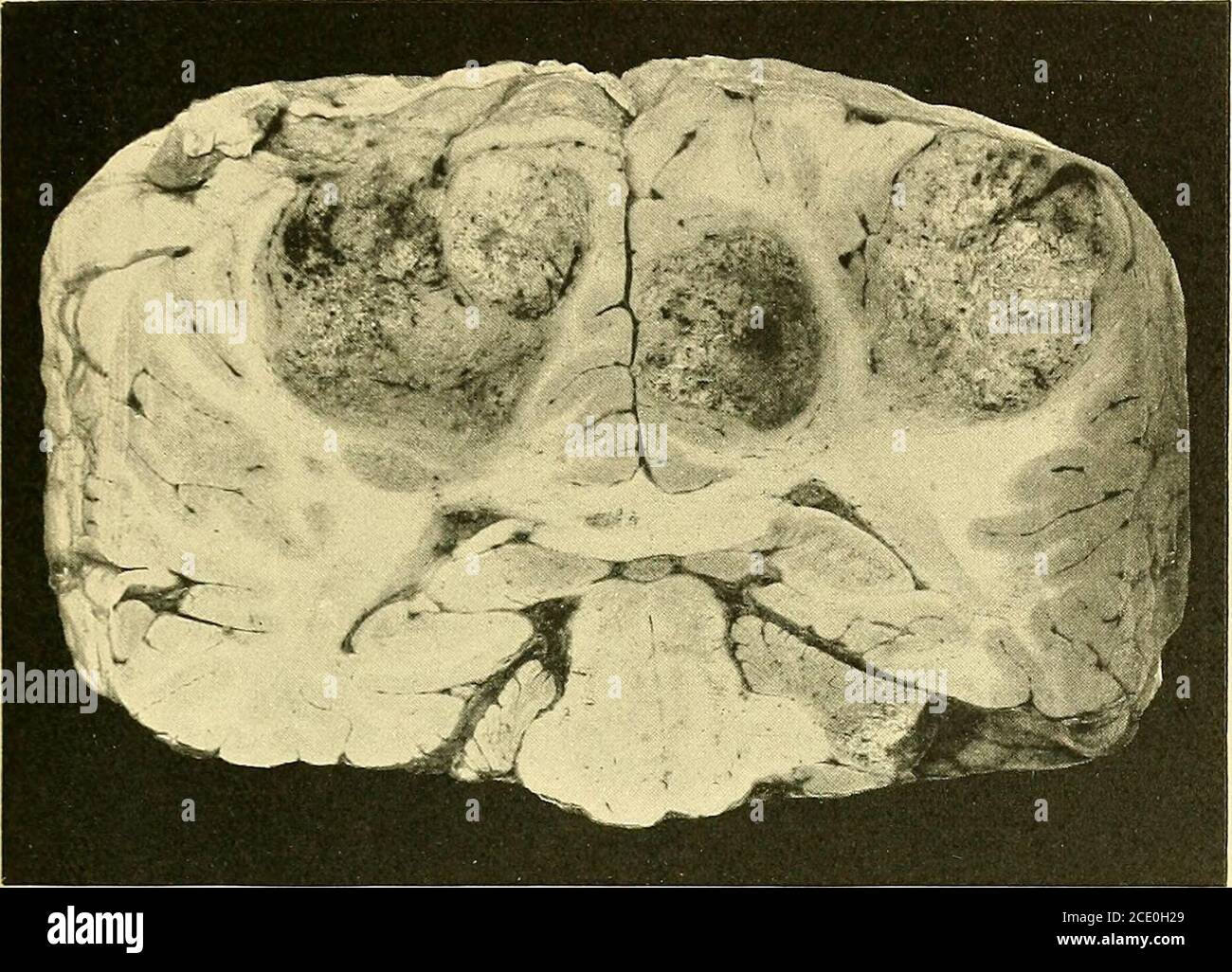. Some points in the surgery of the brain and its membranes . Fig. 66 ...