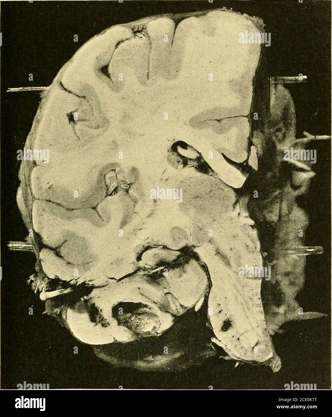 . Some points in the surgery of the brain and its membranes . on in ...