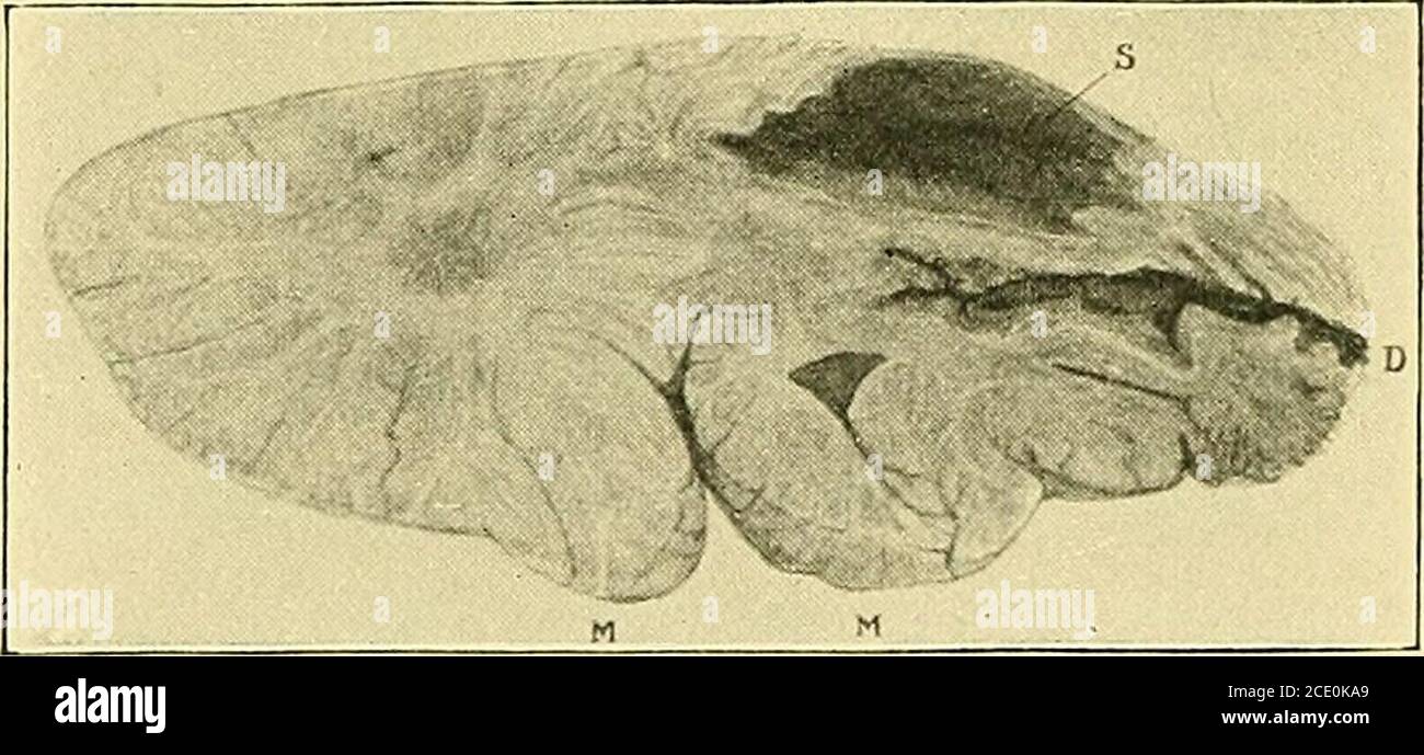 . Some points in the surgery of the brain and its membranes . Fig. 55 ...